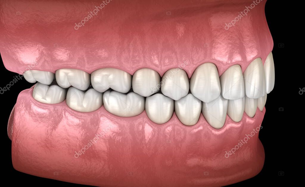 Dientes humanos sanos con oclusión normal. Ilustración 3D de dientes ...