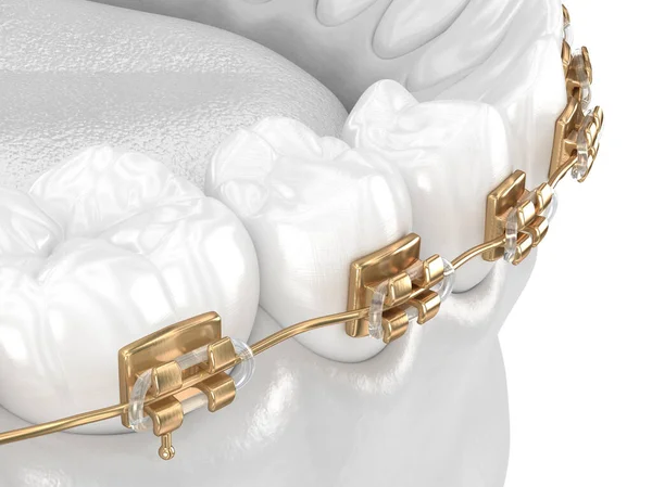 Gold teeth Images - Search Images on Everypixel