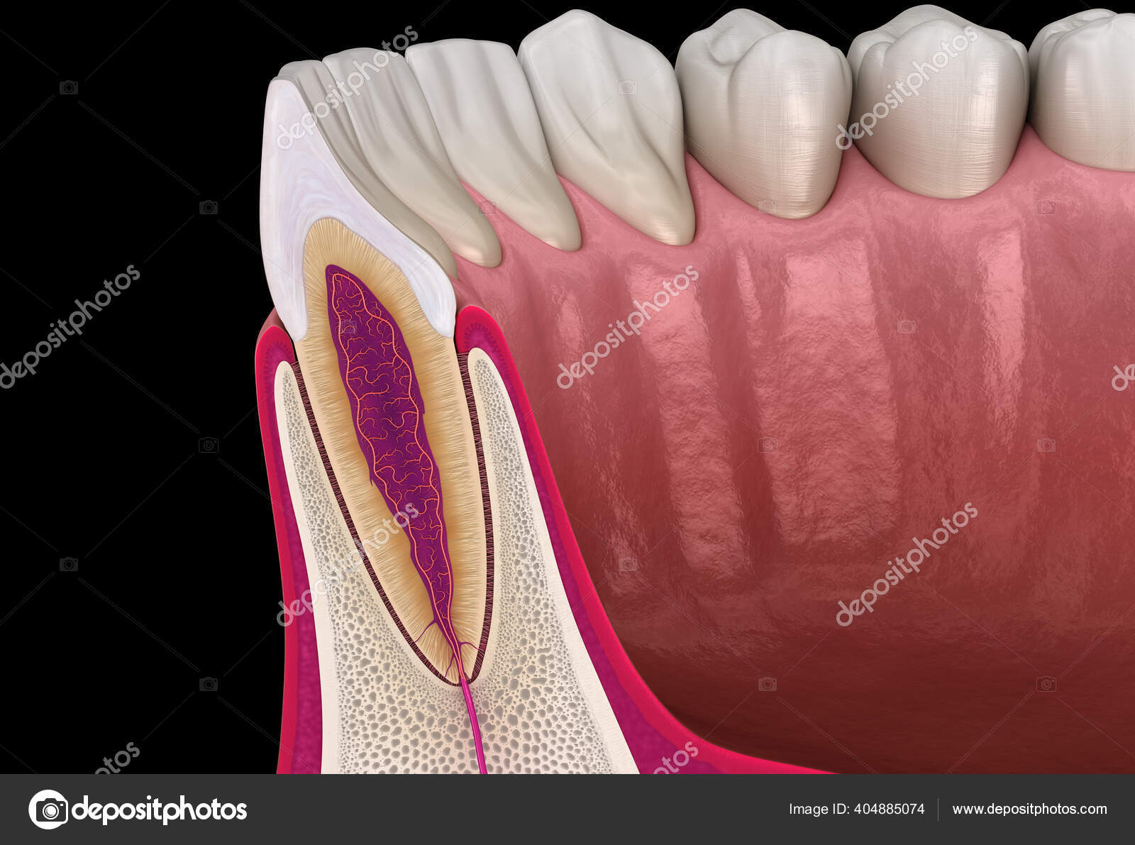 Anatomía Dental Del Incisivo Central Maxilar Anatomía Dental General