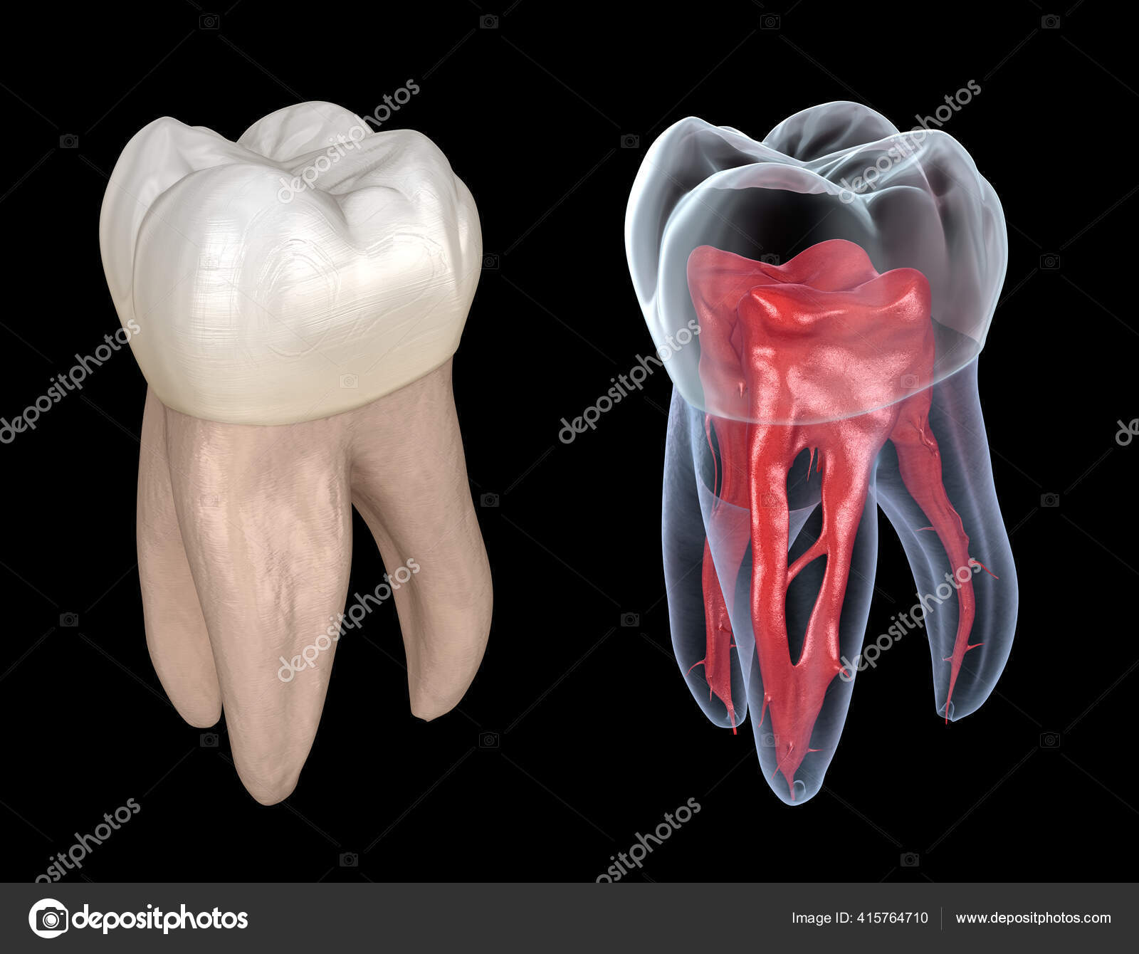 Dental Root Anatomy First Maxillary Molar Tooth Medically Accurate ...