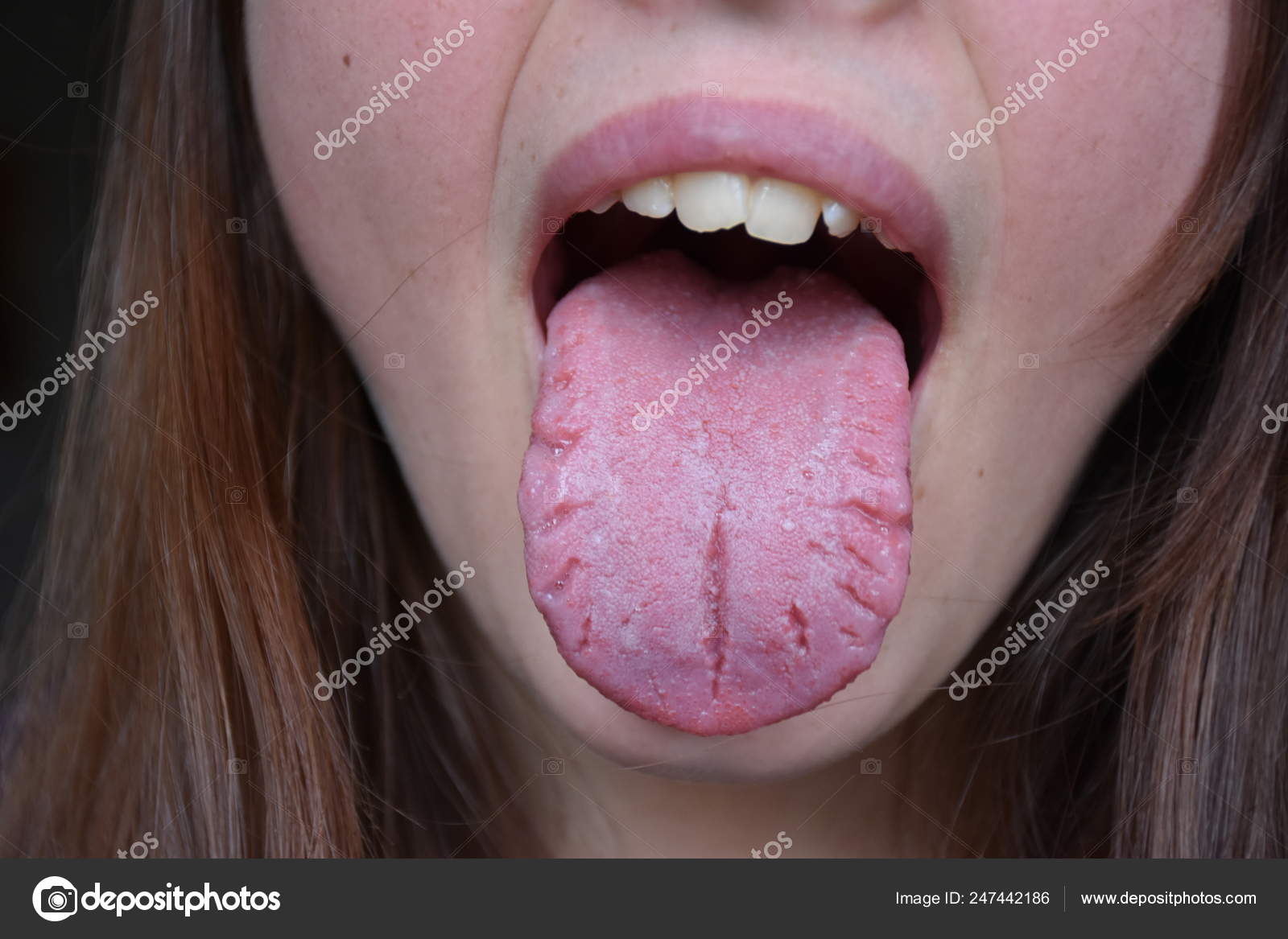 Face Language Young Lady Tongue Teeth Stock Photo by ©GalinkaLB 247442186