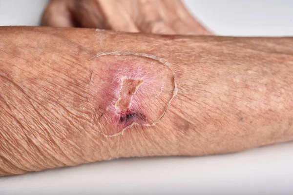 Elderly injury Images - Search Images on Everypixel