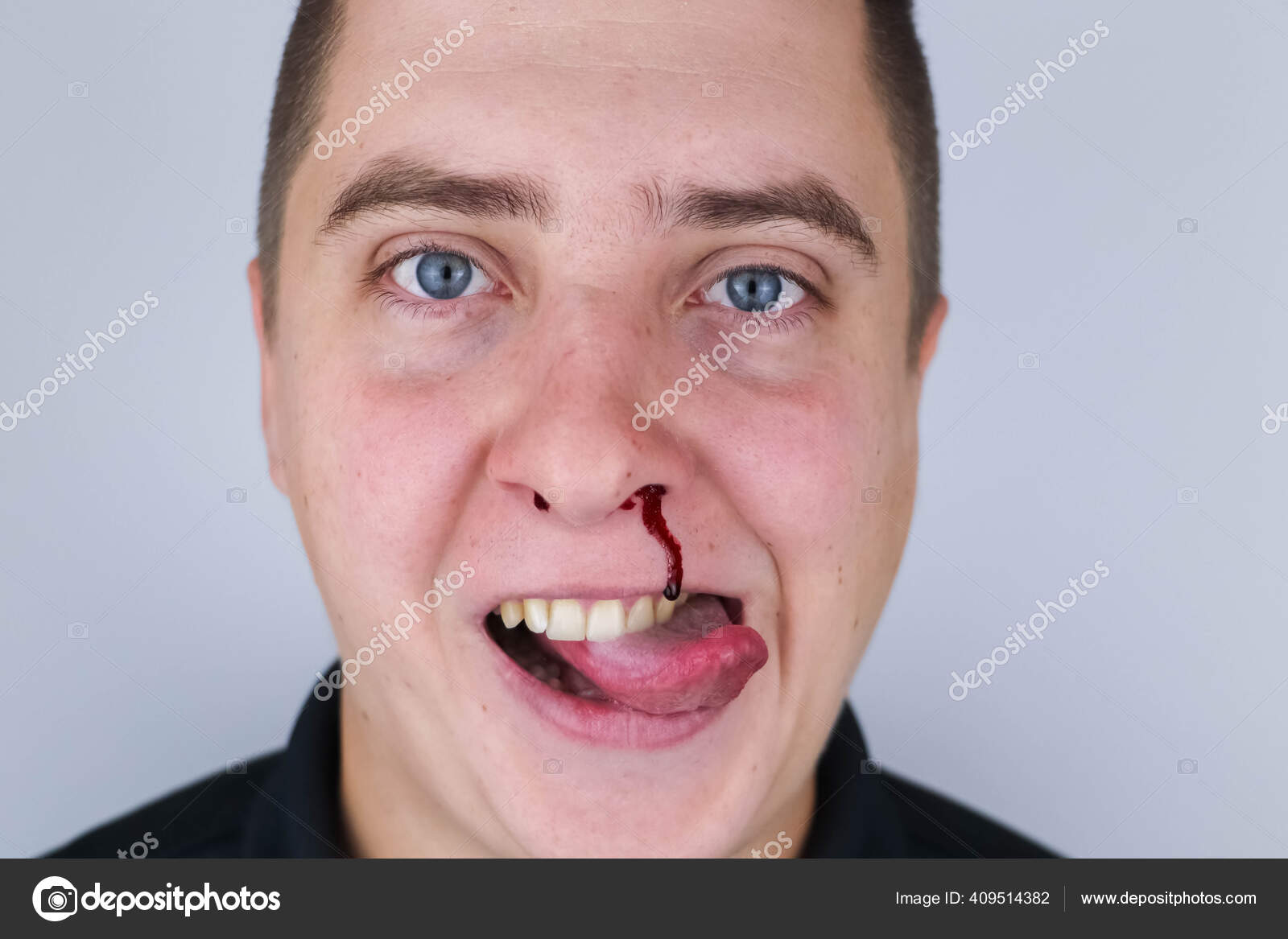 Man Bleeding His Nose Smiles Feels Likes Concept Mazahism Drug — Stock ...