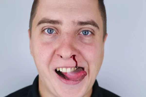 Bleeding Hands Images - Search Images on Everypixel