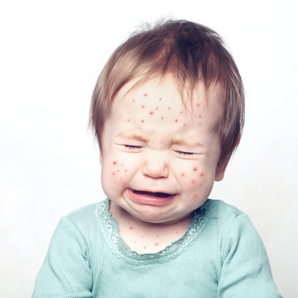 Crying Baby Face With Boogers