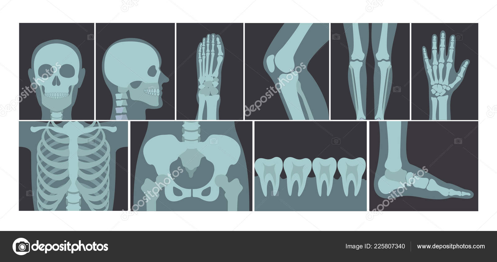 Vector illustration set of many X-rays shots of human body, X-ray ...