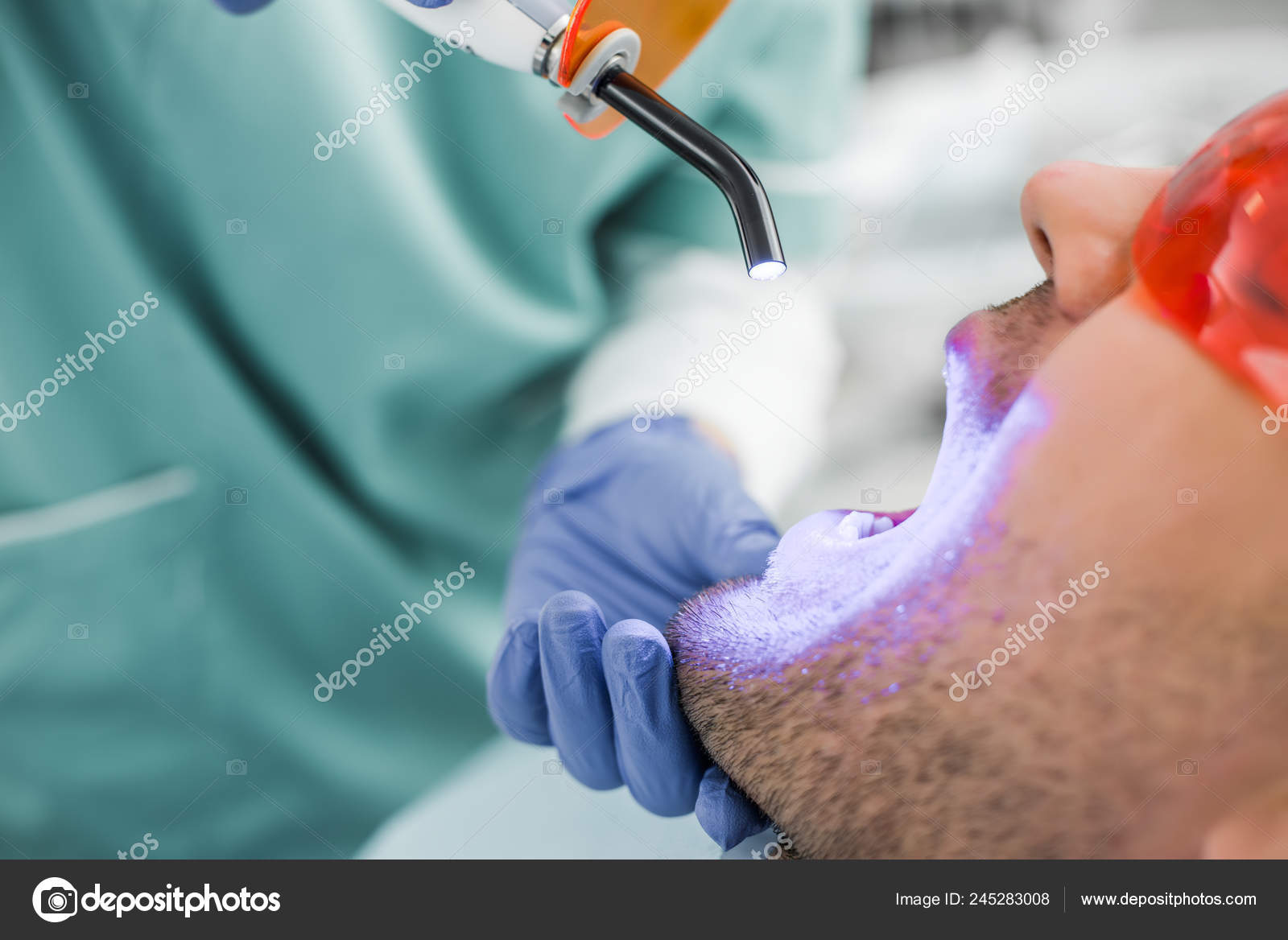 Close Dentist Making Bleaching Procedure Patient — Stock Photo ...