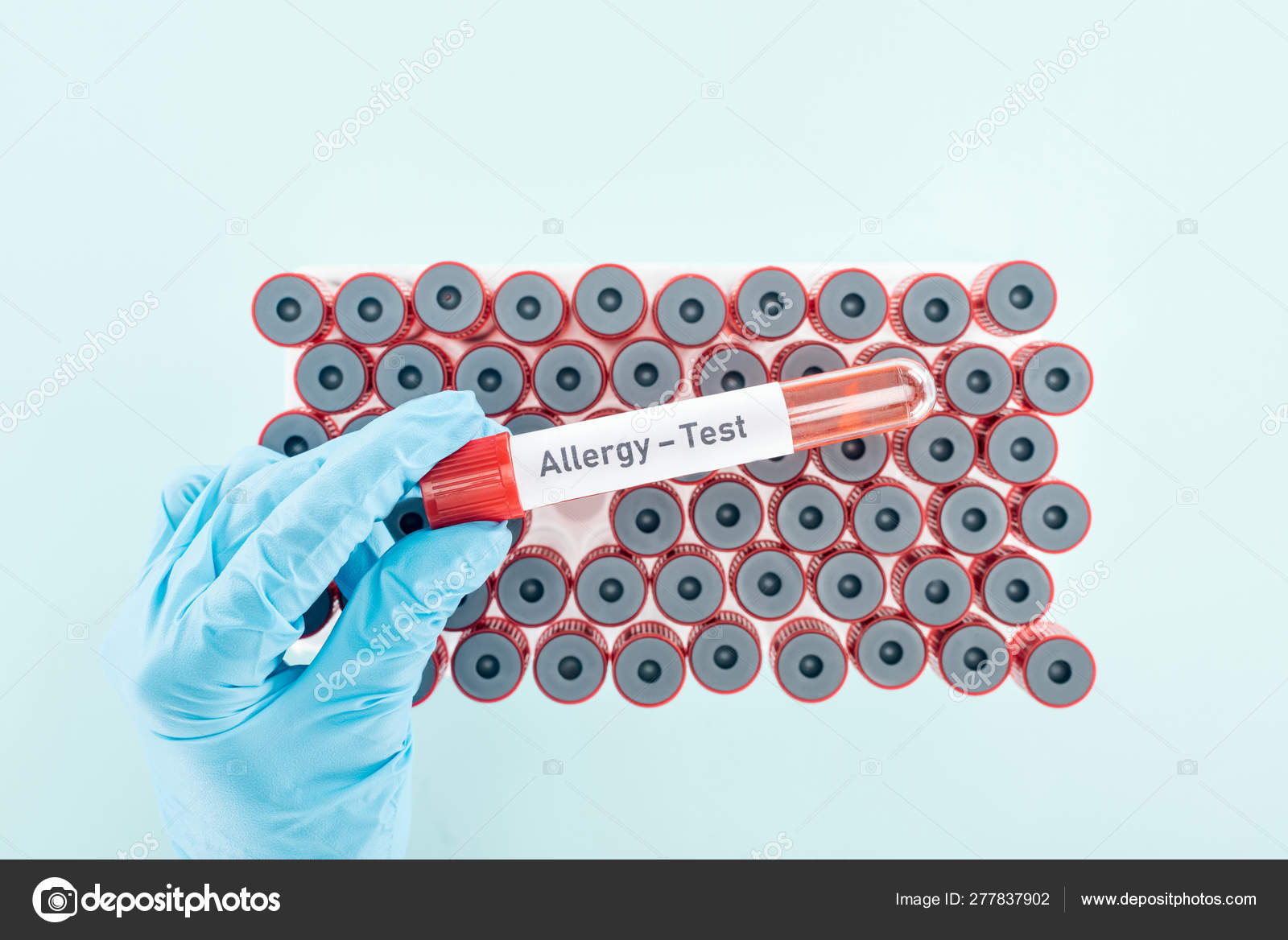 Cropped View Doctor Holding Sample Allergy Test Lettering Test Tubes ...