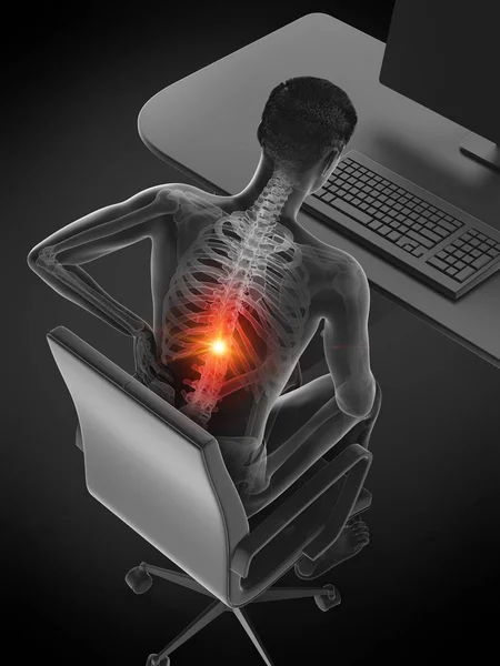 Computer shoulder pain Stock Photos, Royalty Free Computer shoulder ...