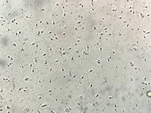 View through microscope at in vitro fertilization process Stock Photo ...