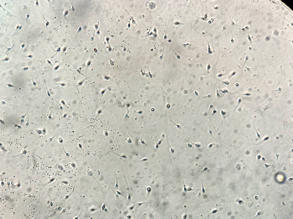 Sperma Al Microscopio