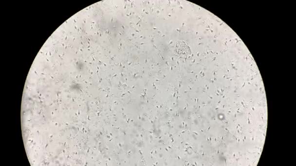 View at human sperm under microscope in lab — Stock Video © bezikus ...