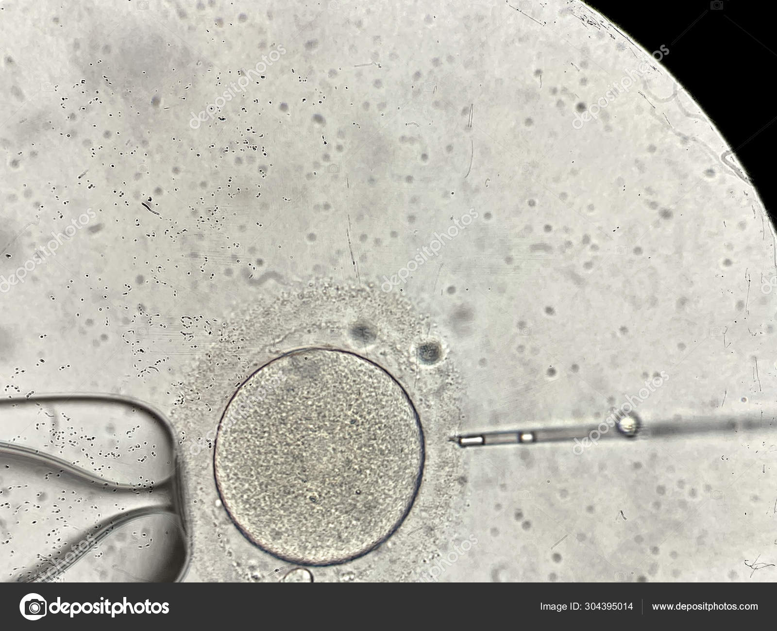 View through microscope at in vitro fertilization process Stock Photo ...