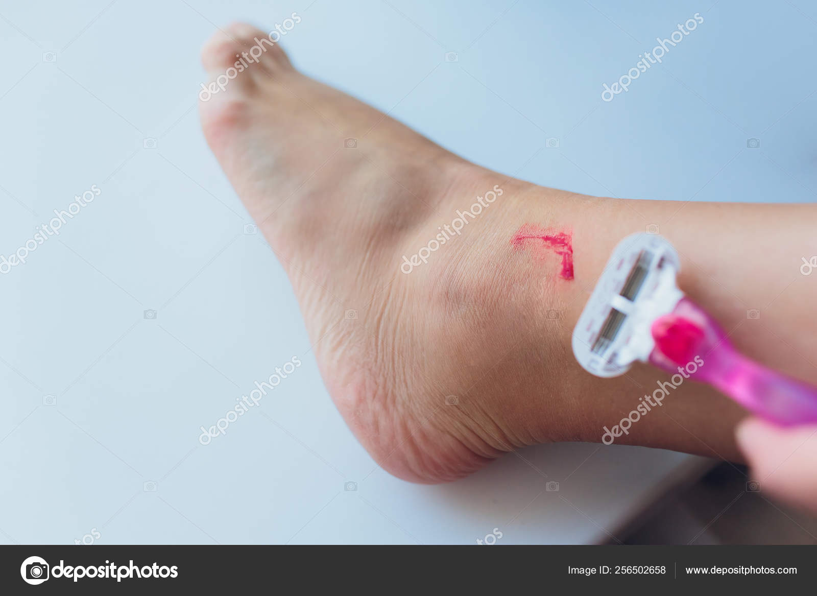 The leg is wound with bleeding caused by scratching. Stock Photo by ...