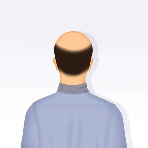 Programmer bald Stock Photos, Royalty Free Programmer bald Images ...