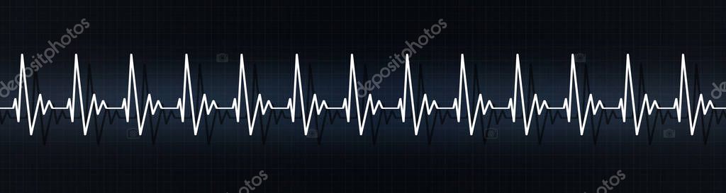 Rapid pulse Pictures, Rapid pulse Stock Photos & Images | Depositphotos®