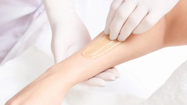 Unwanted hair wax epilation. Young Woman. cosmetology salon treatment ...