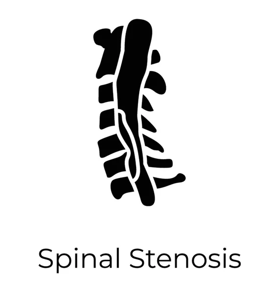 Stenosis Stock Vectors, Royalty Free Stenosis Illustrations | Depositphotos®