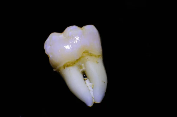 Anatomical structure of the tooth — Stock Photo © obencem #19497283