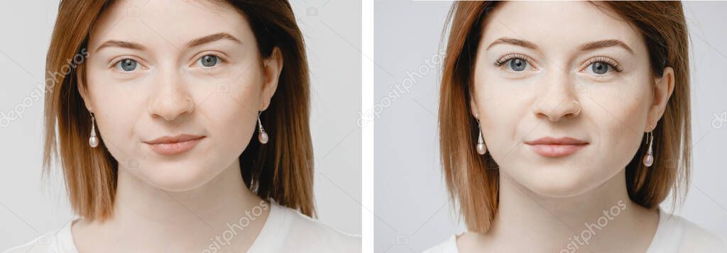 100,000 Cheek augmentation Vector Images | Depositphotos