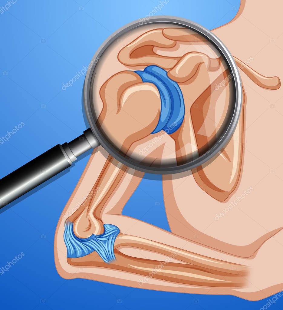 Una Ilustración Articulaciones Hombro Humano Vector de stock por ...