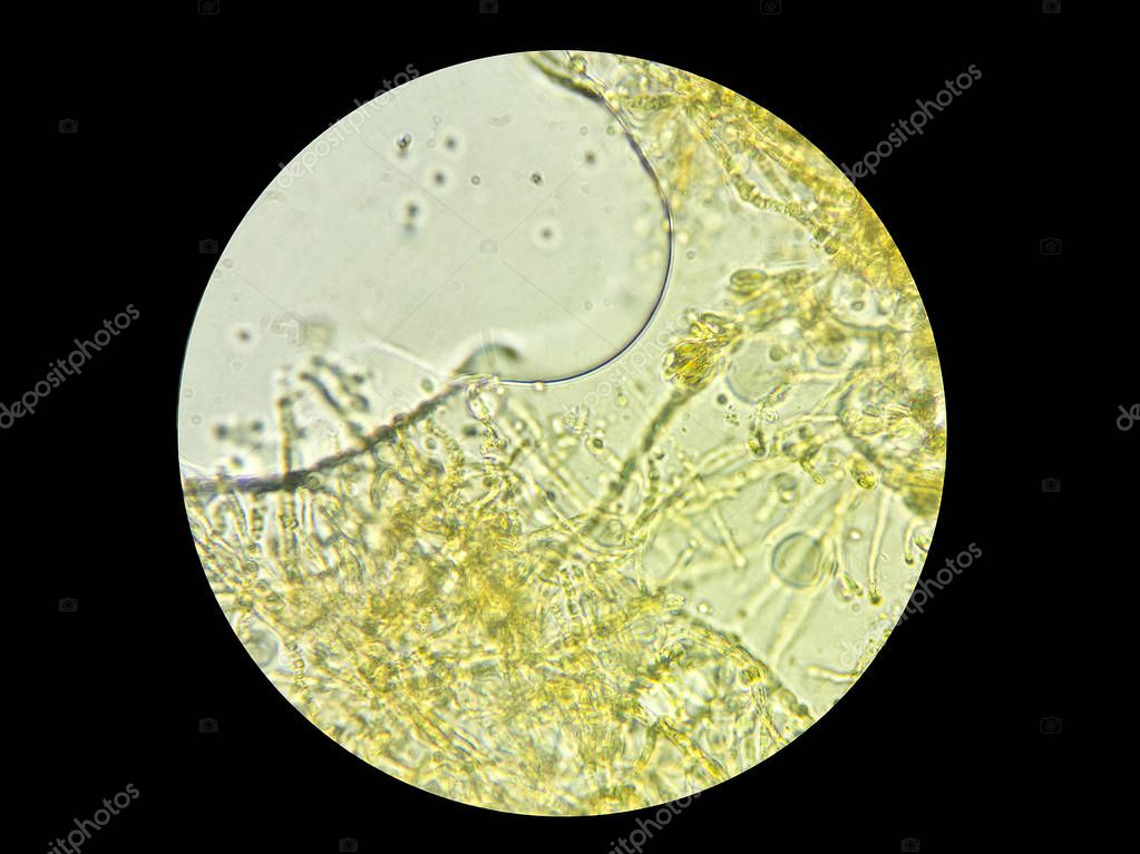 Imagen de hongos microscópicos obtenidos a través de un microscopio de ...