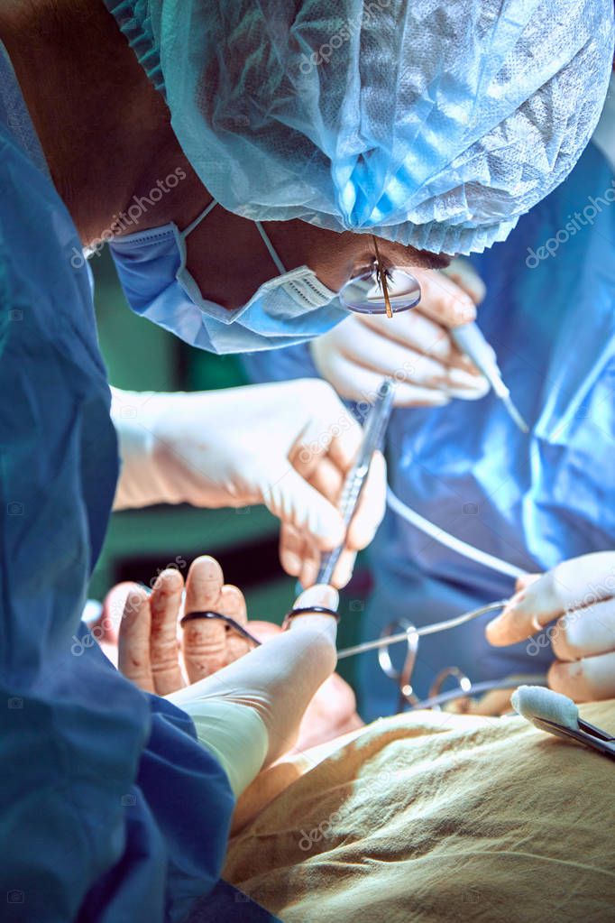 Aumento de reducci n de ment n doble eliminaci n de ment n cirug a pl stica concepto de operaci ...