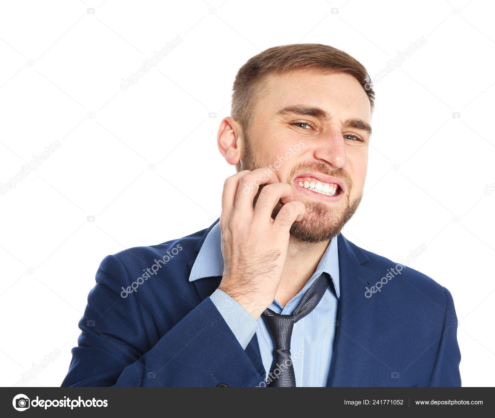 Young Man Scratching Beard White Background Annoying Itch Stock Photo ...