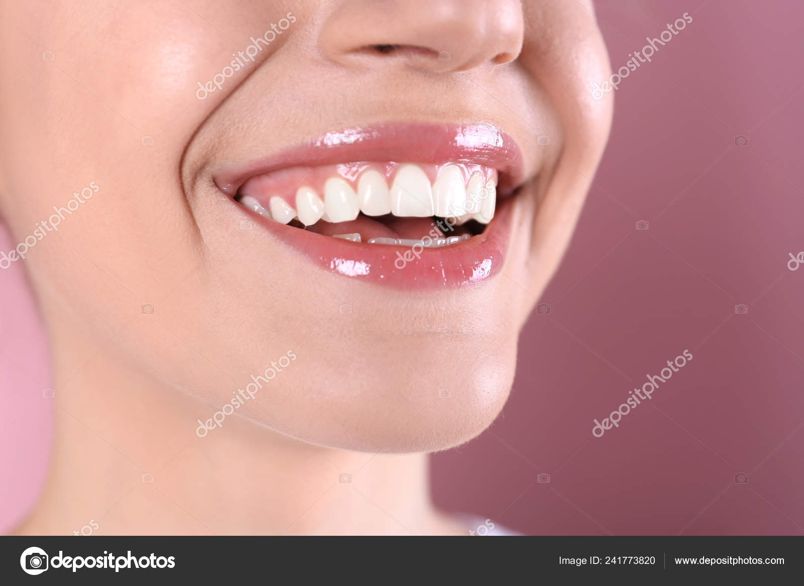 Healthy Teeth Color - Cronoset
