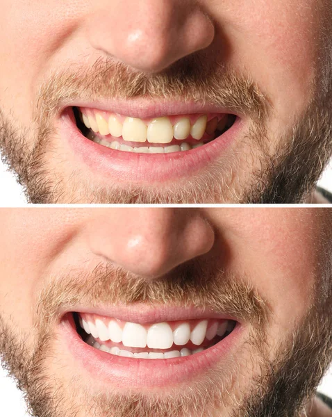 Perfect Male Teeth