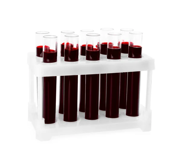 Blood vials rack Stock Photos, Royalty Free Blood vials rack Images ...