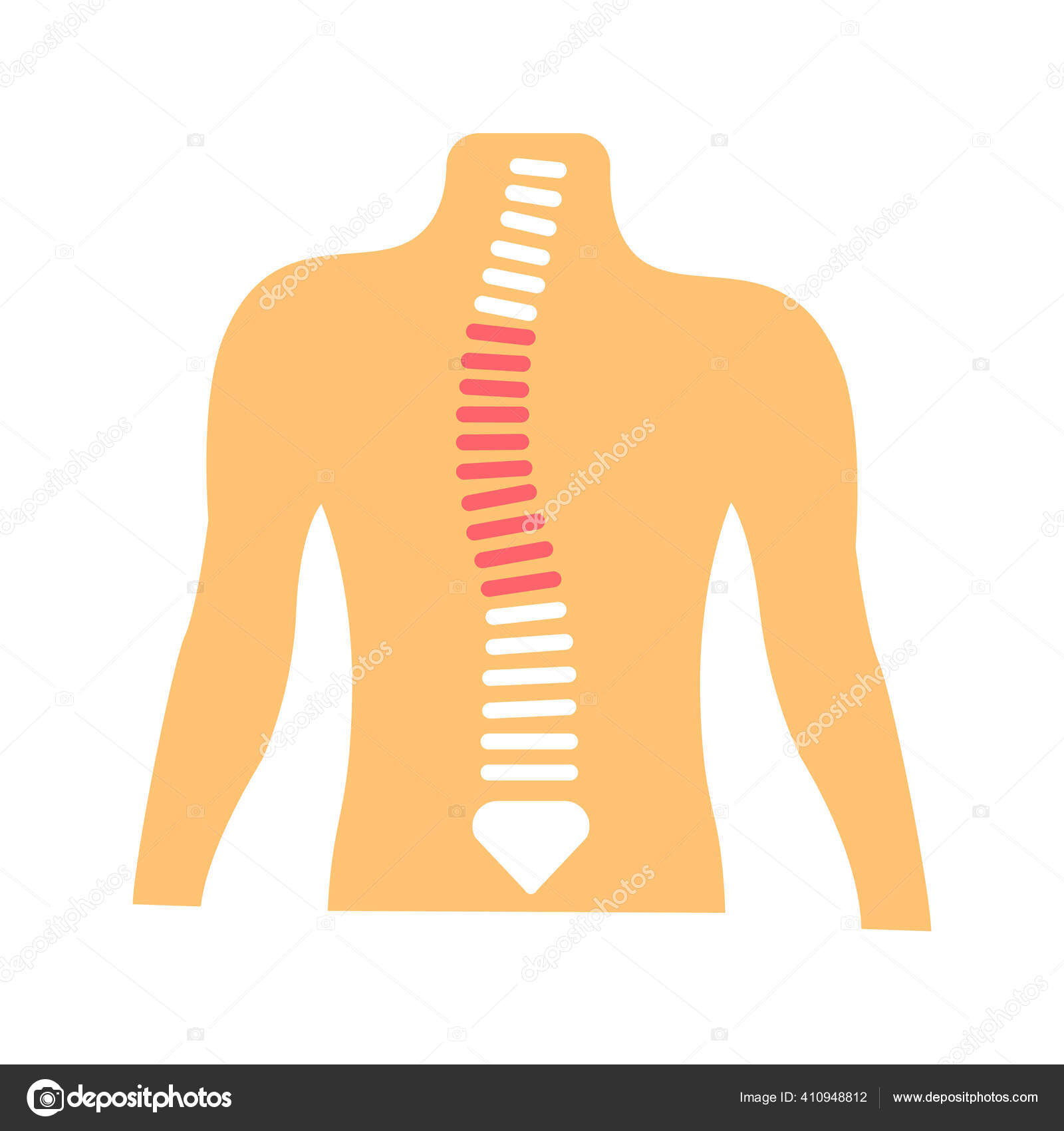Scoliosis Flat Color Icon Spinal Deformity Concept Sign Web Page Stock ...