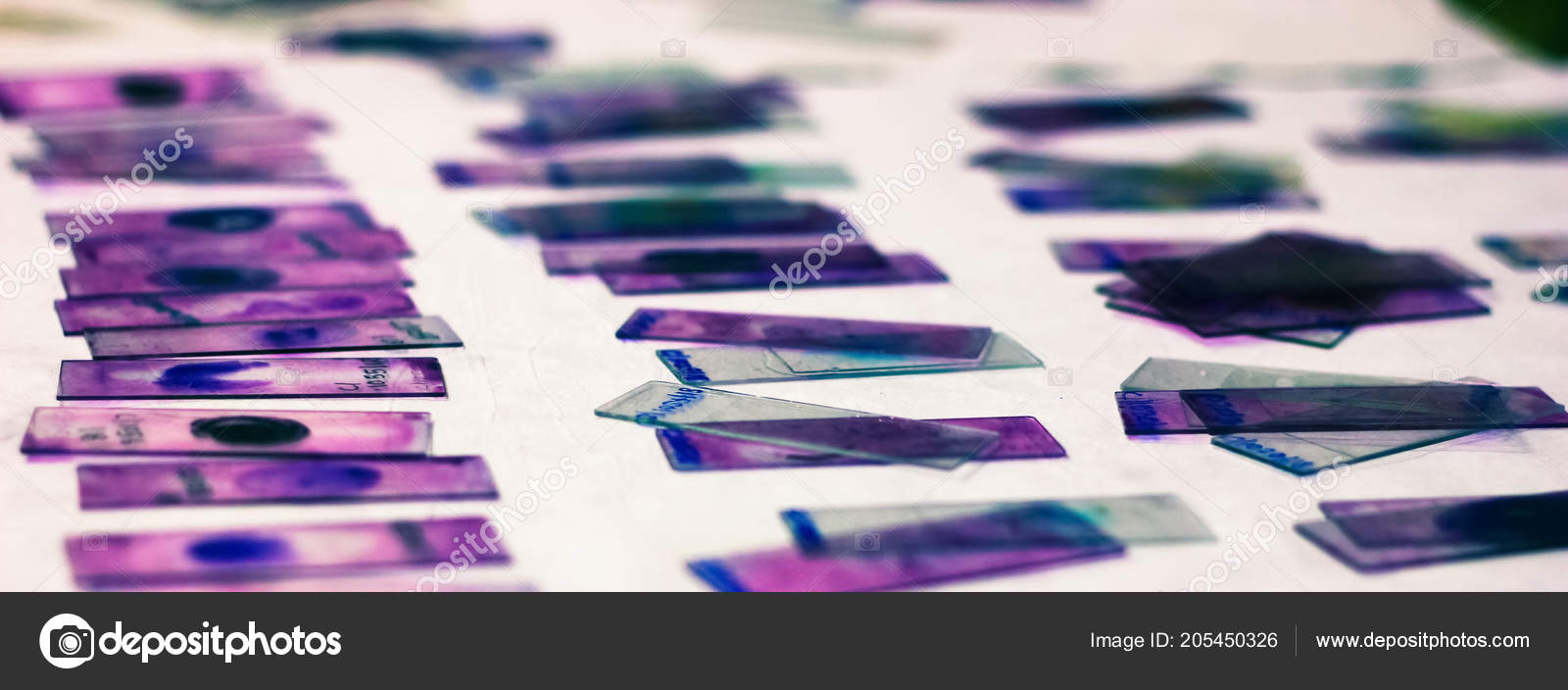 Stained Glass Slides Peripheral Blood Smear Violet Leishman Giemsa ...