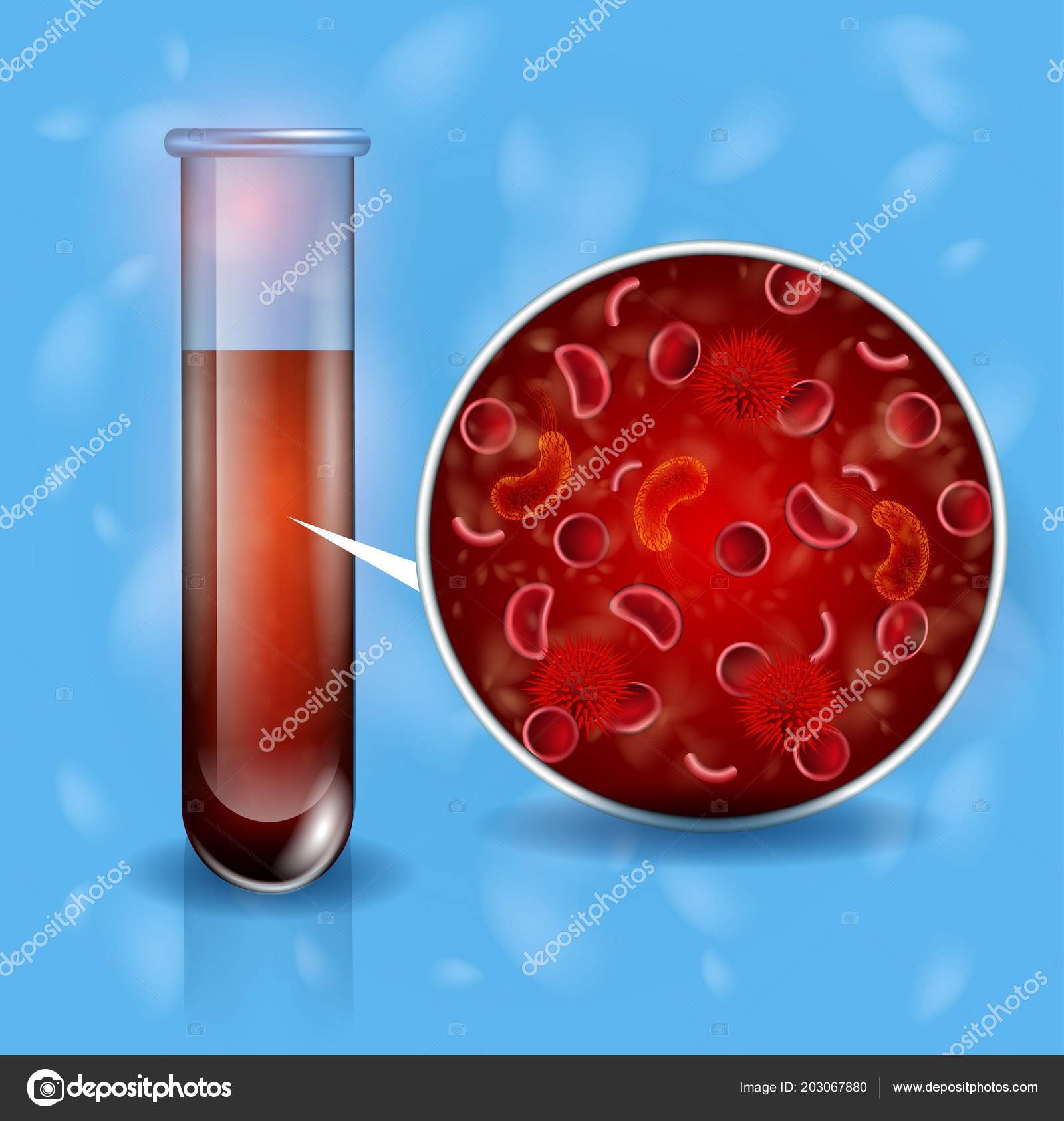Concepto de Vector Realista Humano Enfermo Sangre Vector de stock por ...