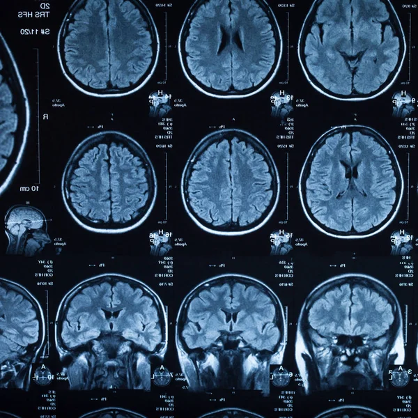 X-ray image of the brain computed tomography Stock Photo by ©Elet_1 ...