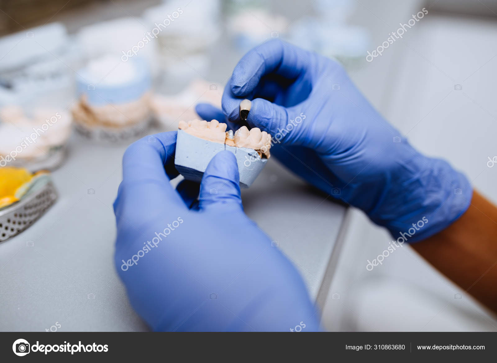 Dental Prosthesis Prosthetics Work Close Prosthetic's Hands While ...
