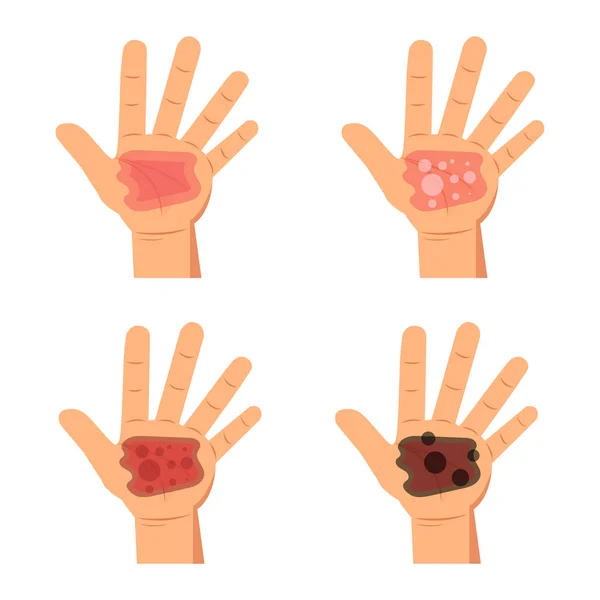 62 Skin burns Vector Images | Depositphotos