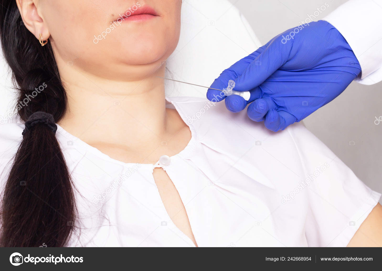The doctor makes the patient double chin thread lifting with absorbable ...