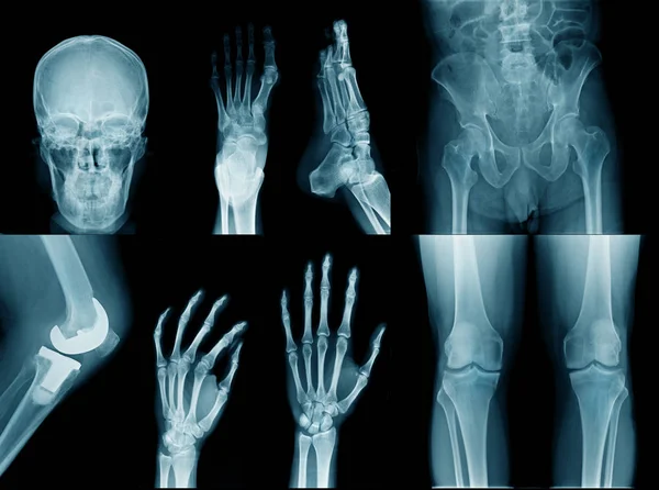 Lab results and x ray Stock Photos, Royalty Free Lab results and x ray ...