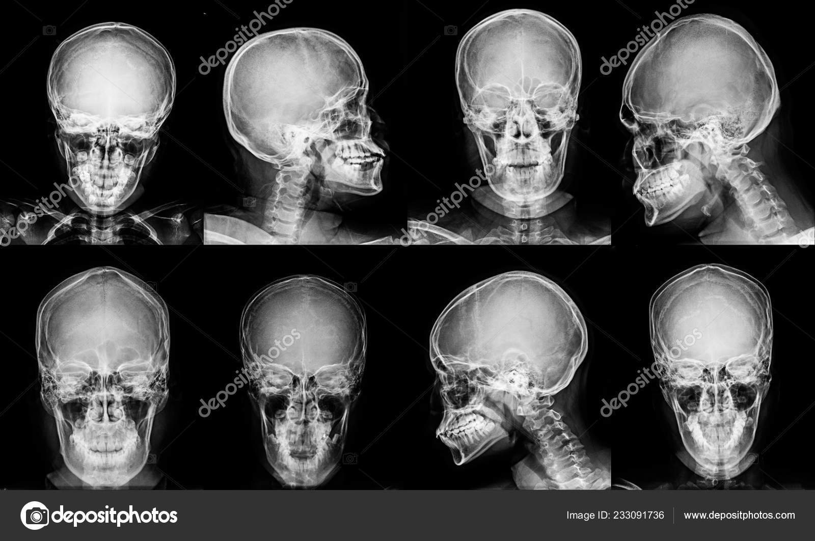 Collection Skull Ray Gray Tone Stock Photo by ©Tridsanu 233091736