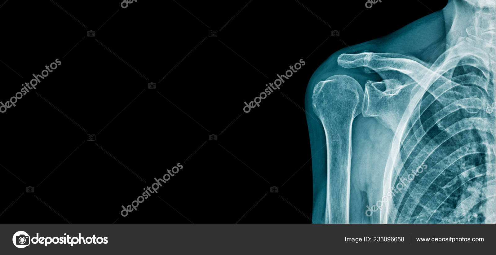 Chest Ray High Quality Ray Image — Stock Photo © Tridsanu #233096658