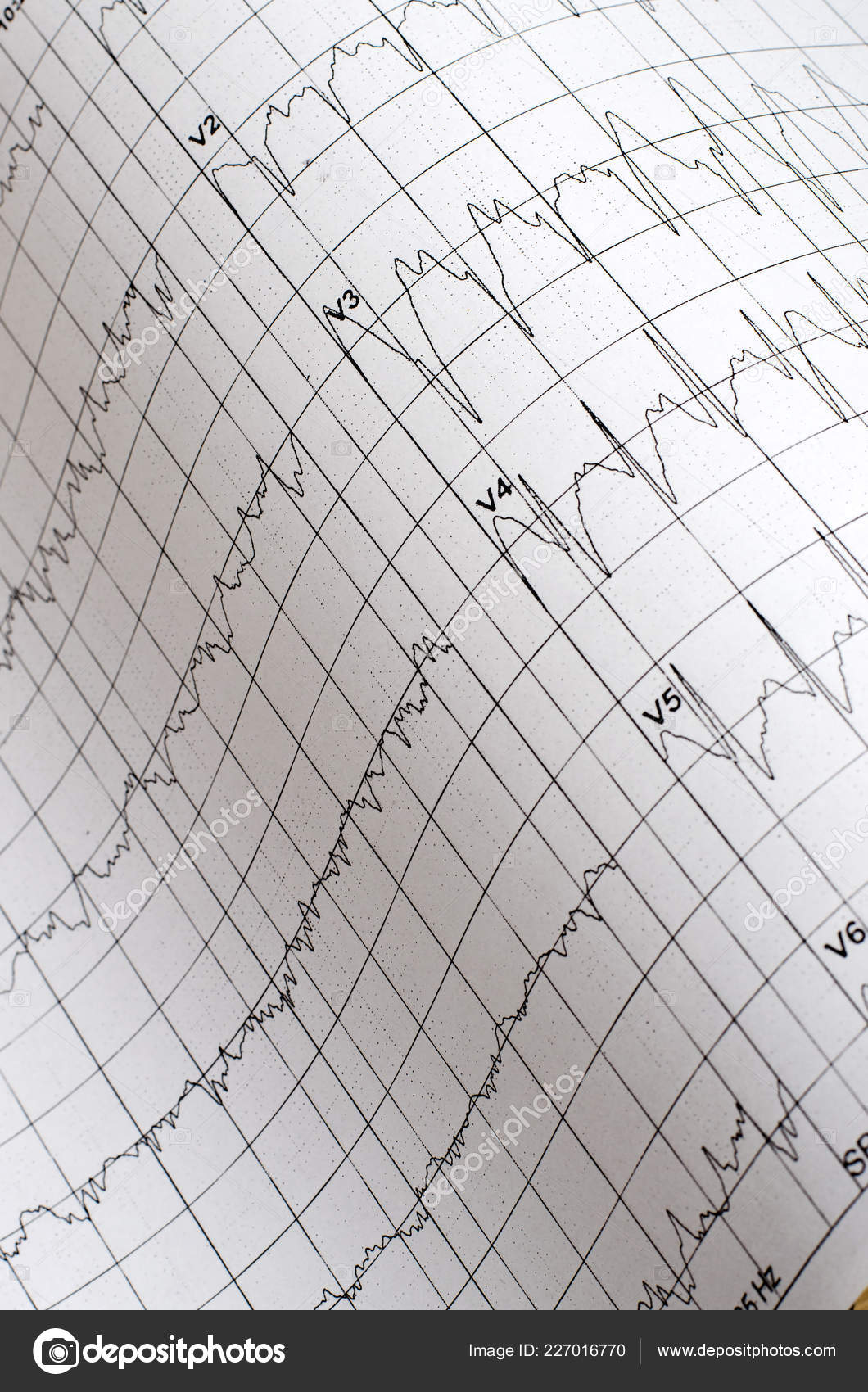Electrocardiogram Chart Medical Background Close Stock Photo by ...