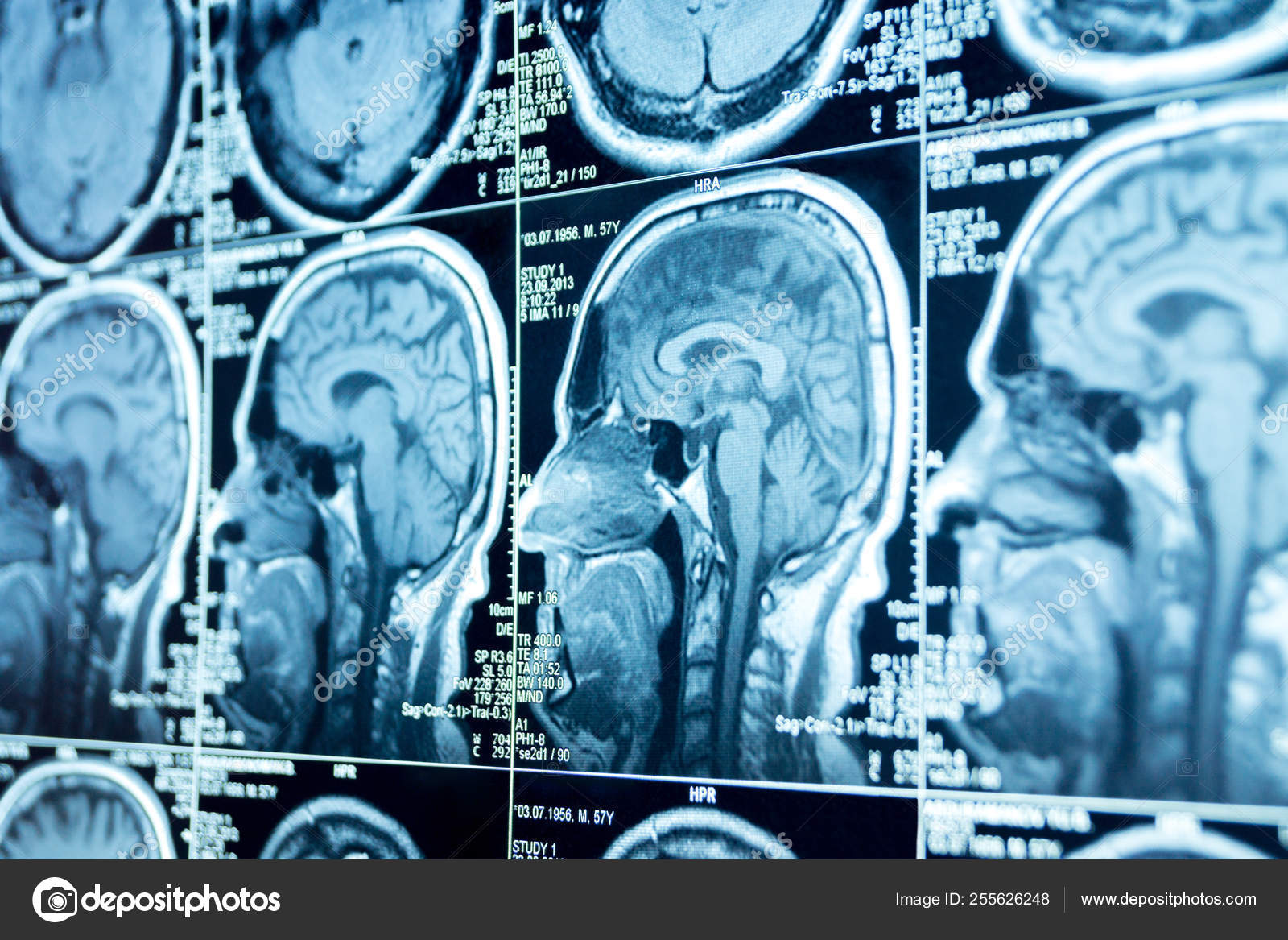 MRI scan of the brain Stock Photo by ©Elena281 255626248