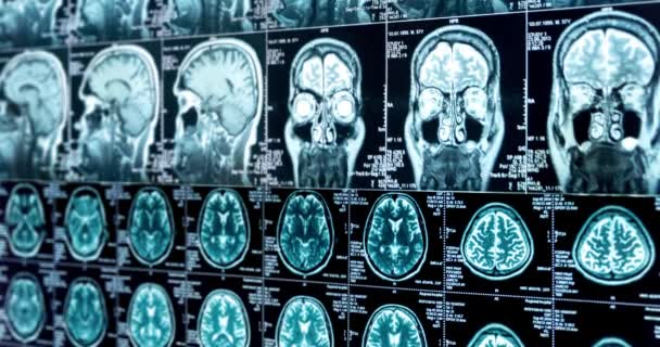 MRI scans of various sizes scroll down, looped ⬇ Video by © Elena281 ...