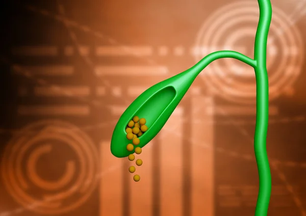 Extracción de vesícula biliar fotos de stock, imágenes de Extracción de ...