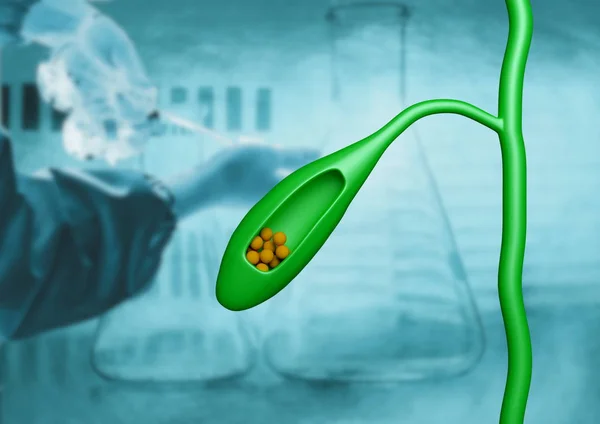 Extracción de vesícula biliar fotos de stock, imágenes de Extracción de ...