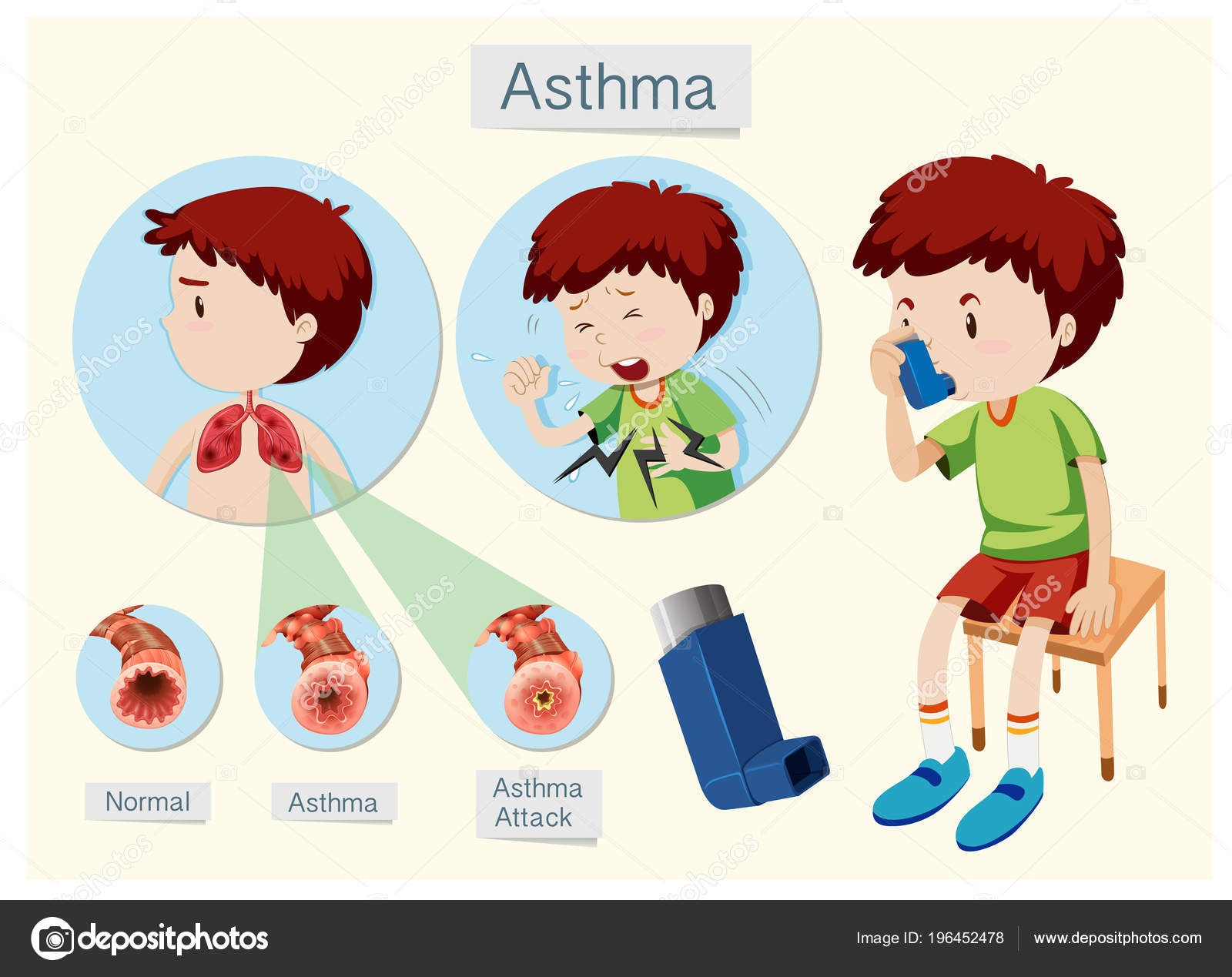 Human Anatomy Health Asthma Illustration Stock Vector Image by ...