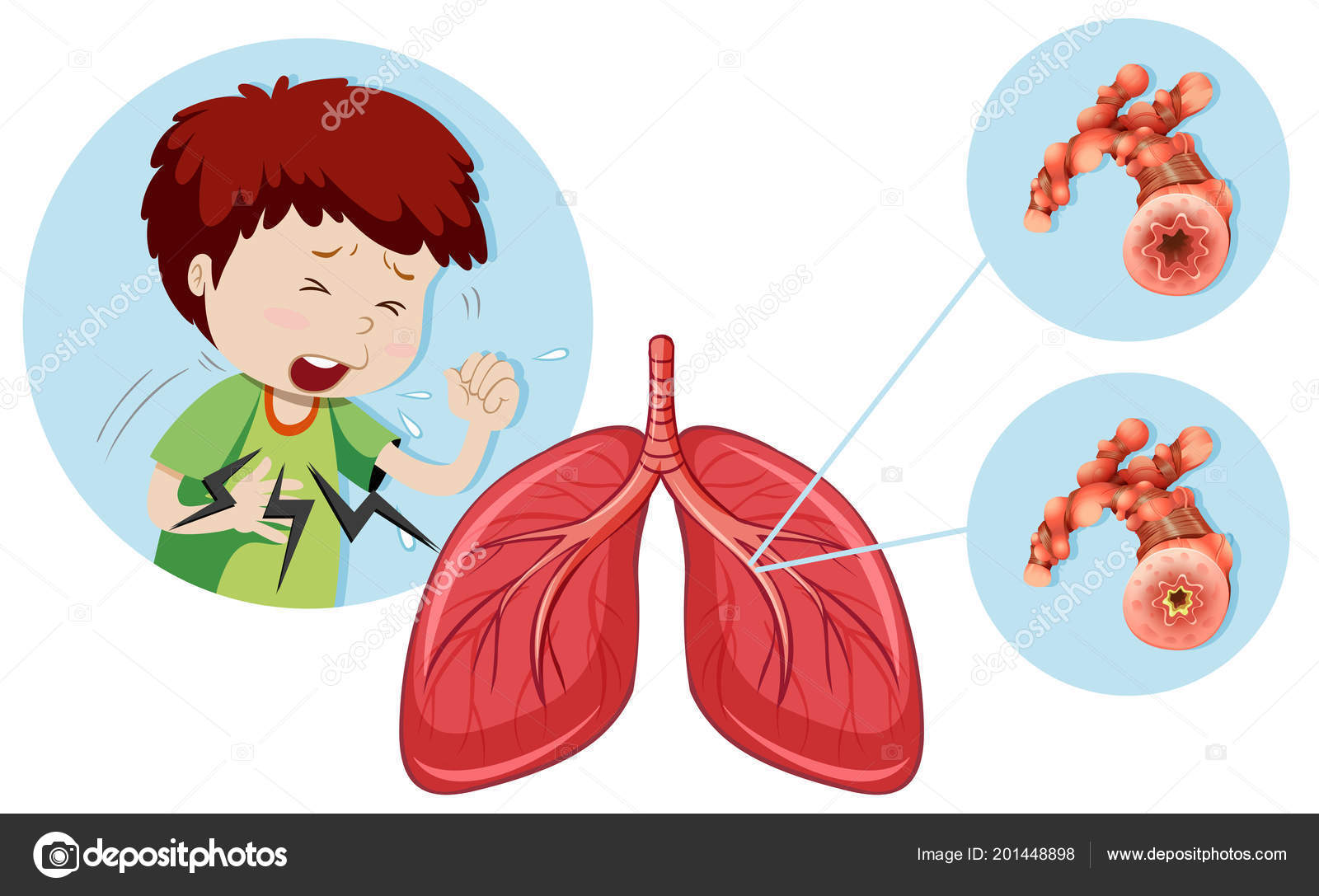 Copd Cartoon Sad