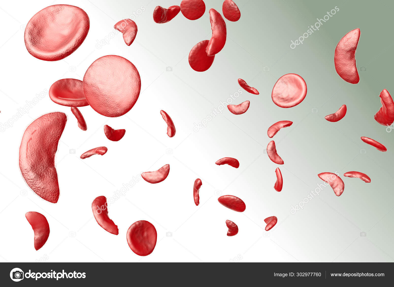 Sickle Cell Anemia 3D Illustration ⬇ Stock Photo, Image by ...