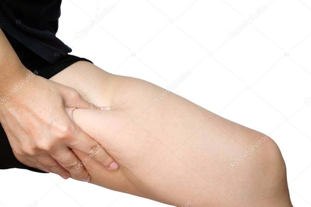 Muslos de piernas femeninas con celulitis aislada sobre fondo blanco ...